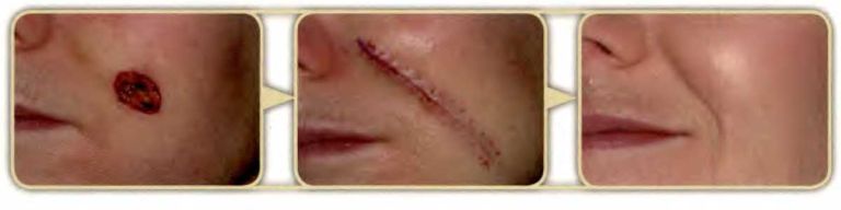 Reconstructive Surgery